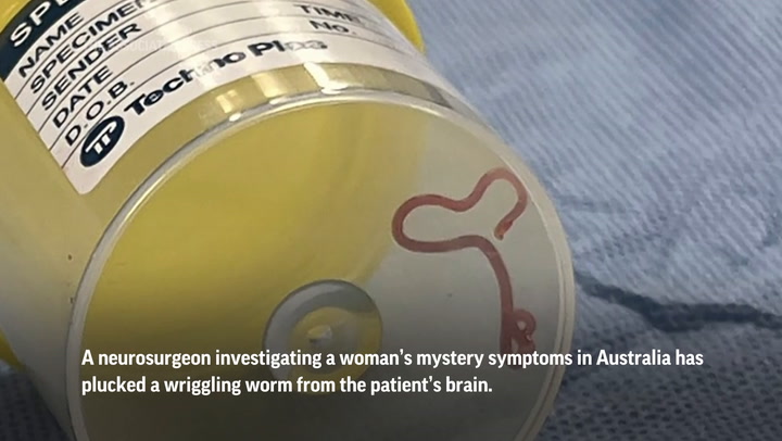 National Post | Neurosurgeon Plucks Worm From Woman'S Brain In Australia